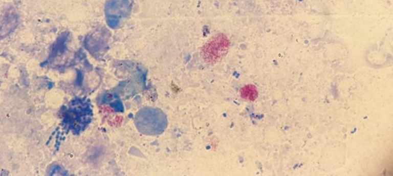 How to Spot Q Fever and What Action to Take | Helping farmers in Scotland